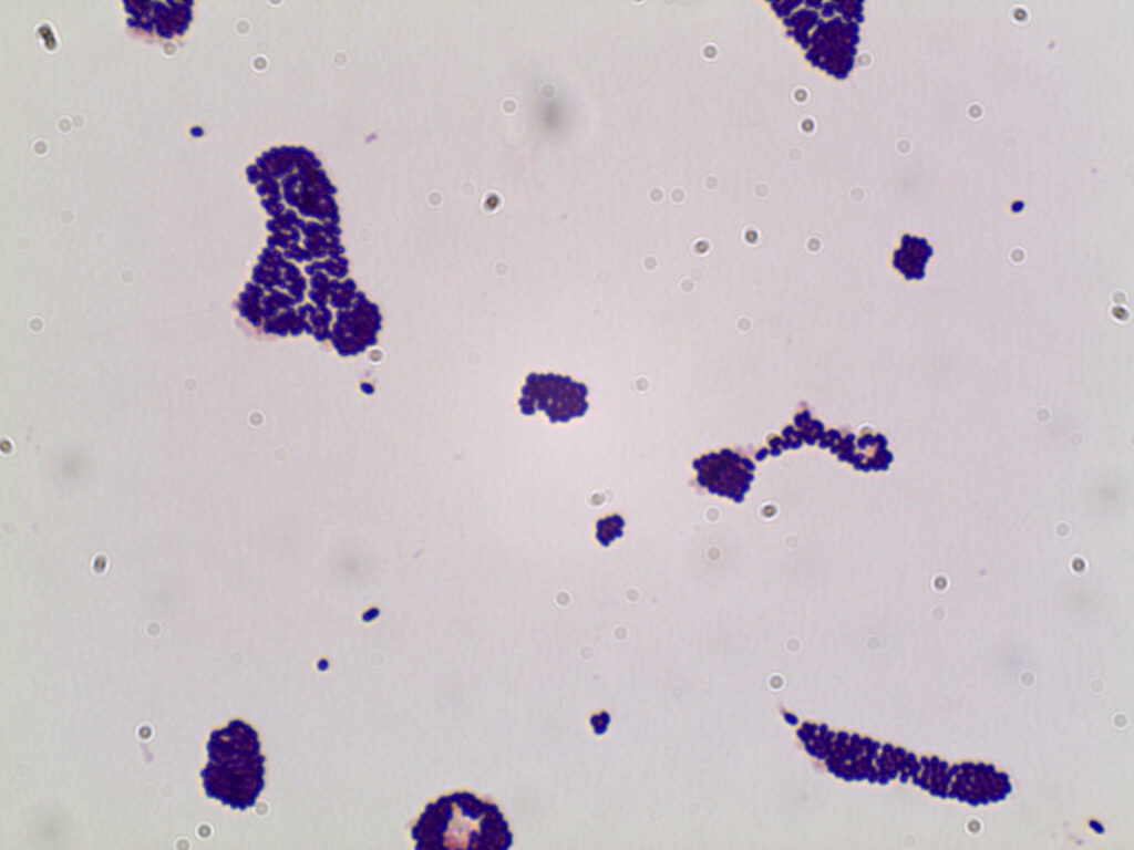 Influence of lincomycin-spectinomycin treatment on the outcome of ...